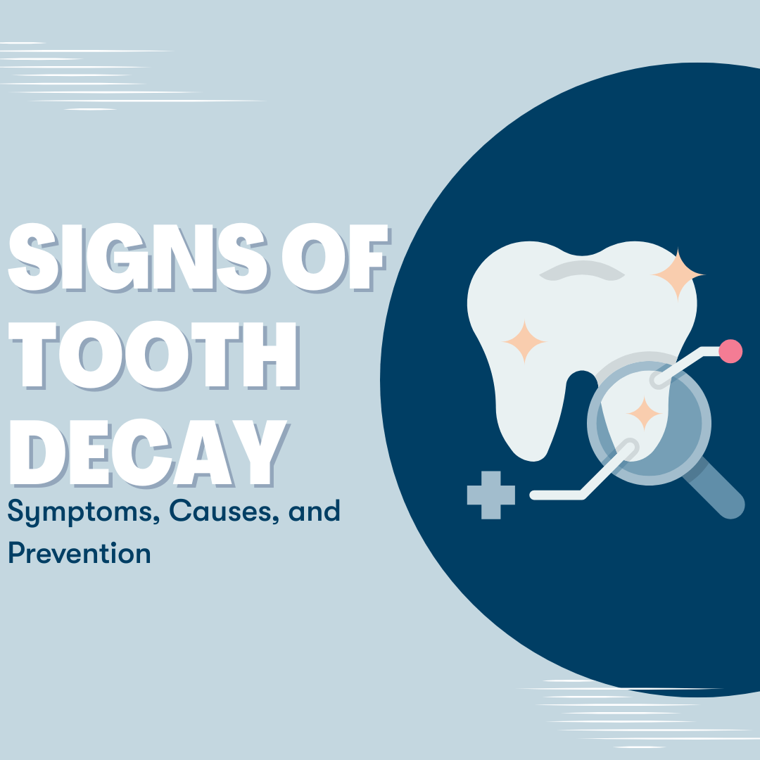Signs of Tooth Decay: Symptoms, Causes, and Prevention - Wagoner Family ...